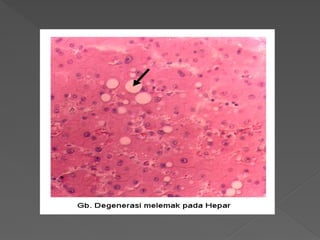 Degenerasi dan nekrosis sel_power point presentation | PPTX