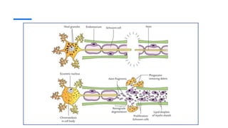 Degeneration and regeneration of nerve.ppt