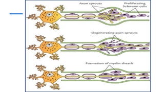 Degeneration and regeneration of nerve.ppt