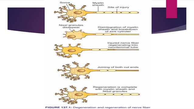 Degeneration and Regeneration of Nerve Fibers.pptx | Brain and Nervous ...