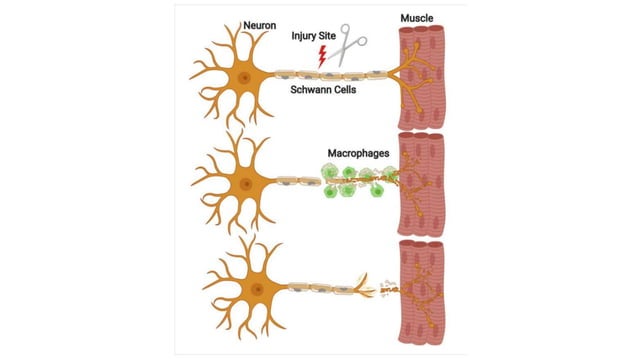 Degeneration & regeneration of nerve fiber.ppt by Dr. PANDIAN M. | PPT | Brain and Nervous ...