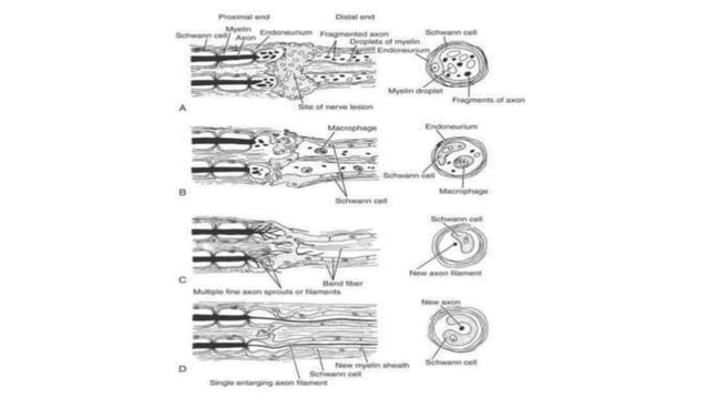 Degeneration & regeneration of nerve fiber.ppt by Dr. PANDIAN M. | PPT | Brain and Nervous ...