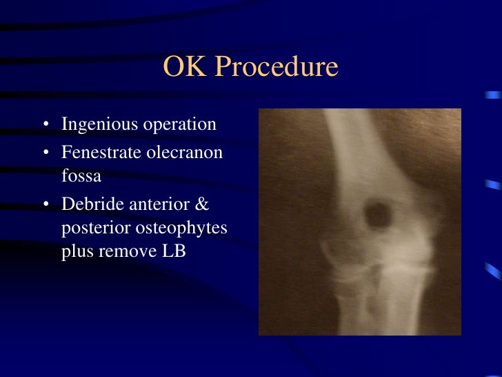 Degenerative arthritis-of-the-elbow