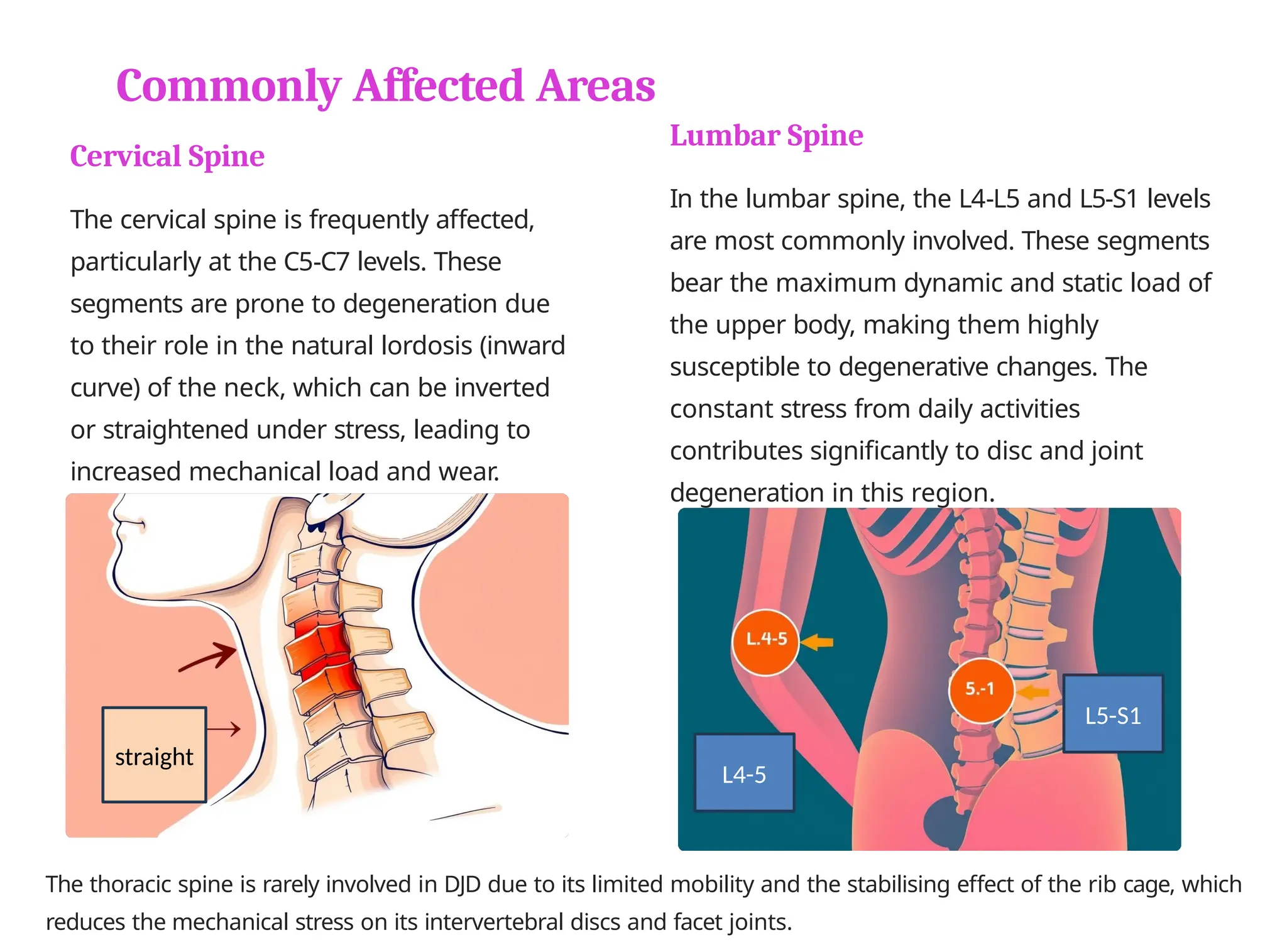 Degenerative-Joint-Disease-DJD-Cervical-Spondylosis-A-Comprehensive ...