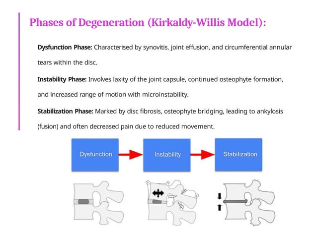 Degenerative-Joint-Disease-DJD-Cervical-Spondylosis-A-Comprehensive ...