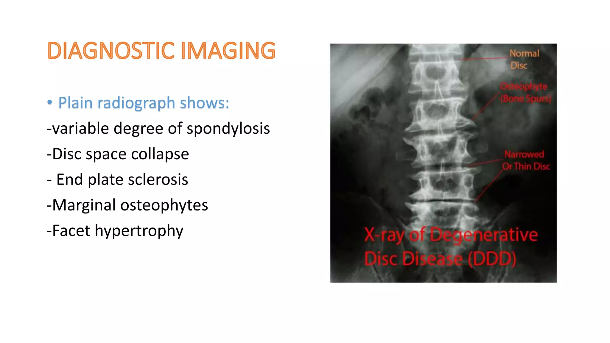 DEGENERATIVE DISC DISEASE 1.pptx