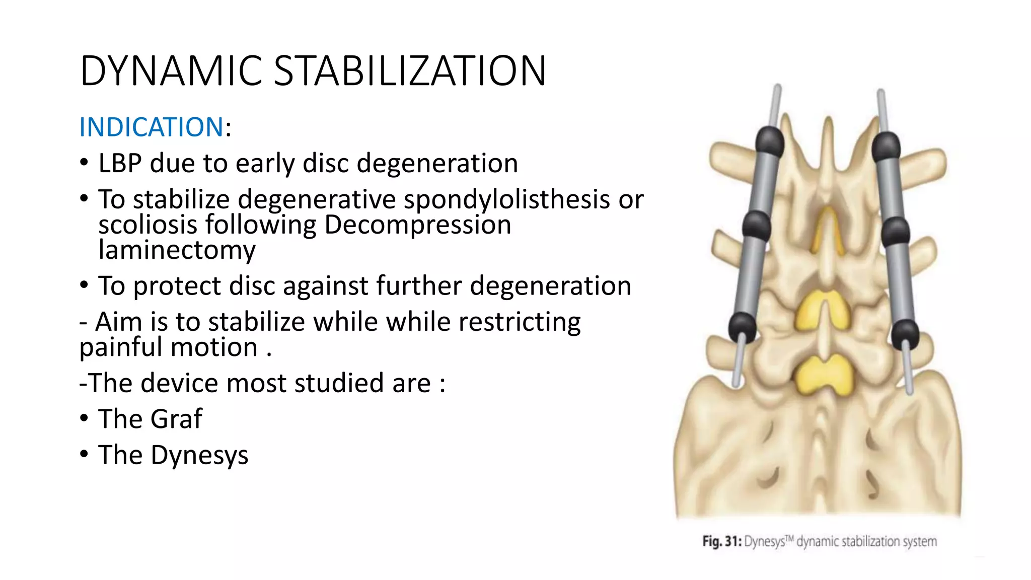 DEGENERATIVE DISC DISEASE 1.pptx