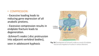 DEGENERATIVE DISC DISEASE 1.pptx