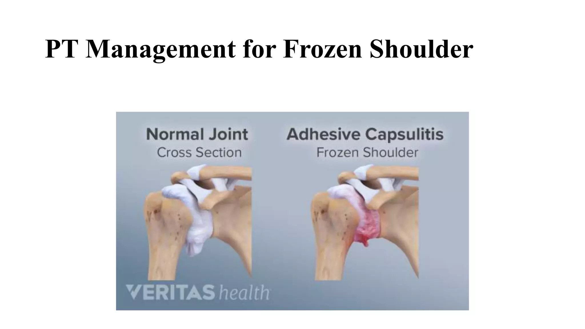 Physiotherapy for Frozen shoulder and Rheumatoid arthritis | PPTX