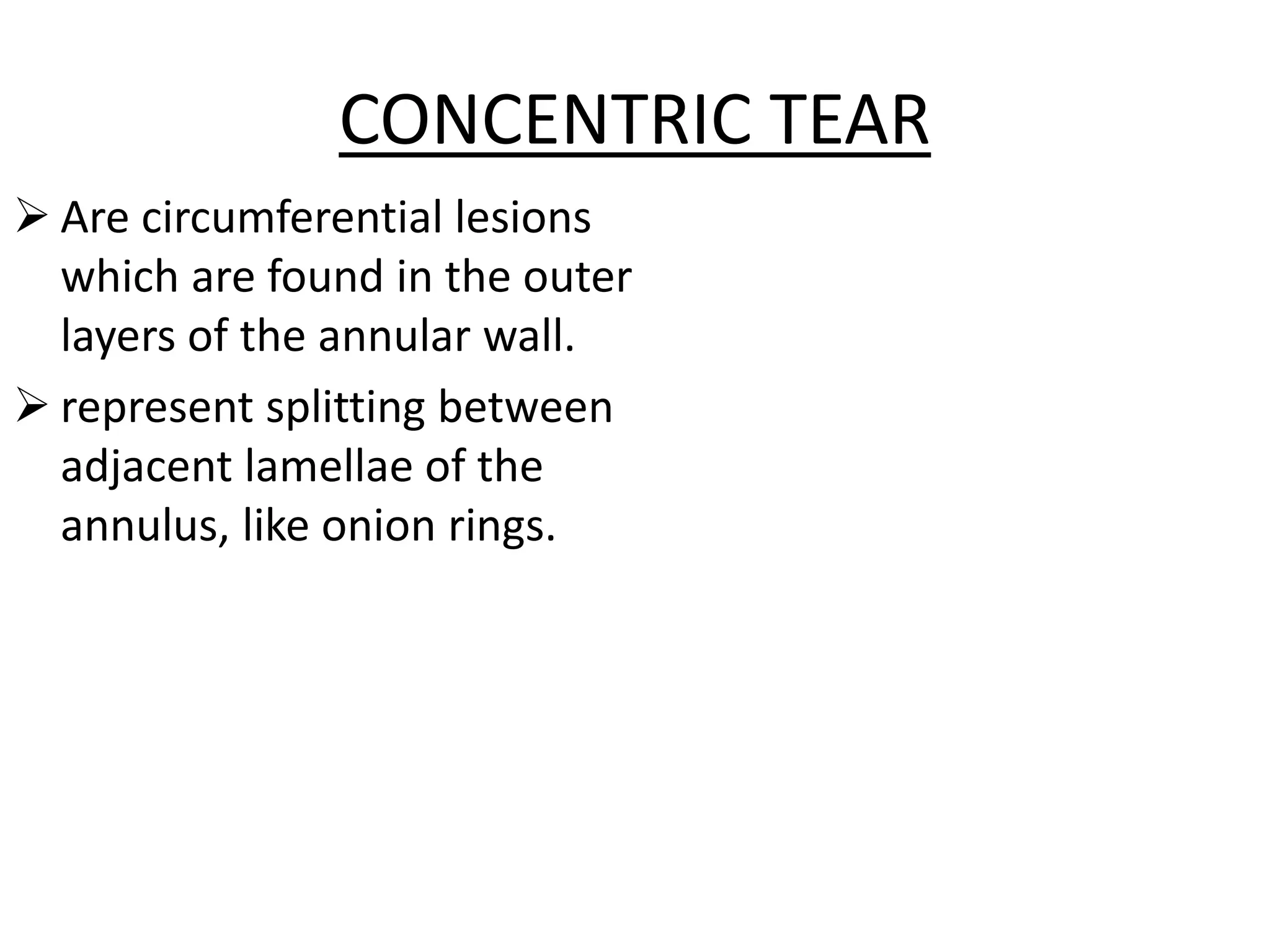Degenerative diseases of spine : Imaging | PPTX