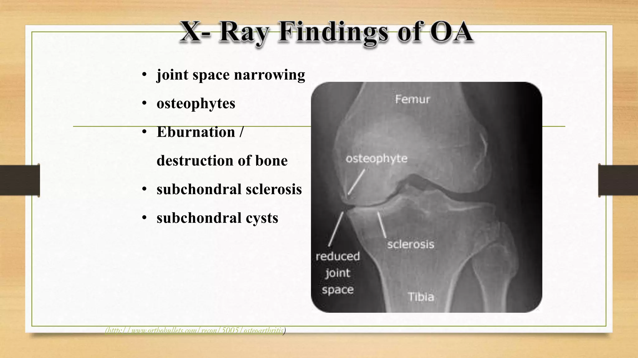 DEGENERATIVE JOINT DISEASE.pptx