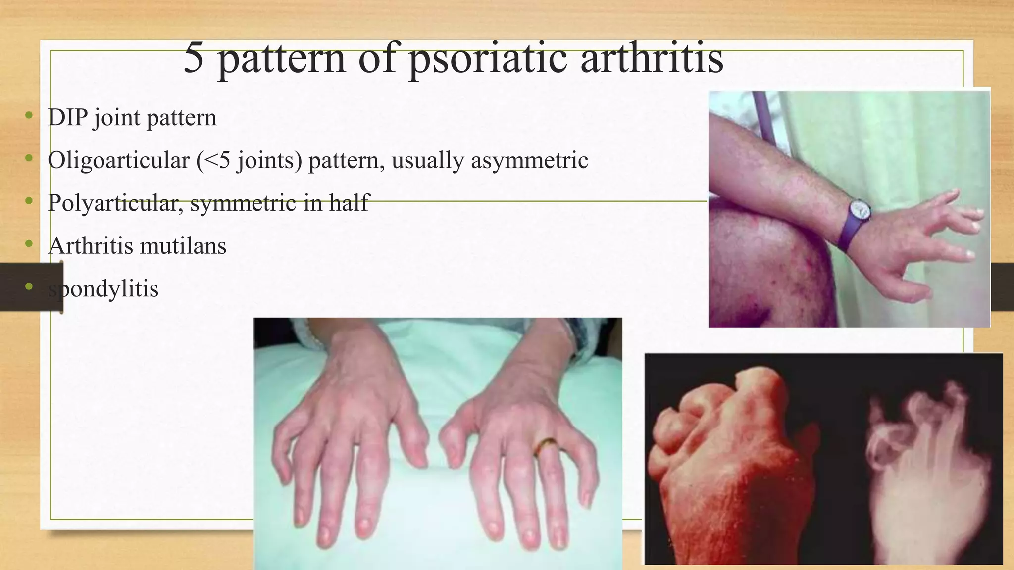 DEGENERATIVE JOINT DISEASE.pptx