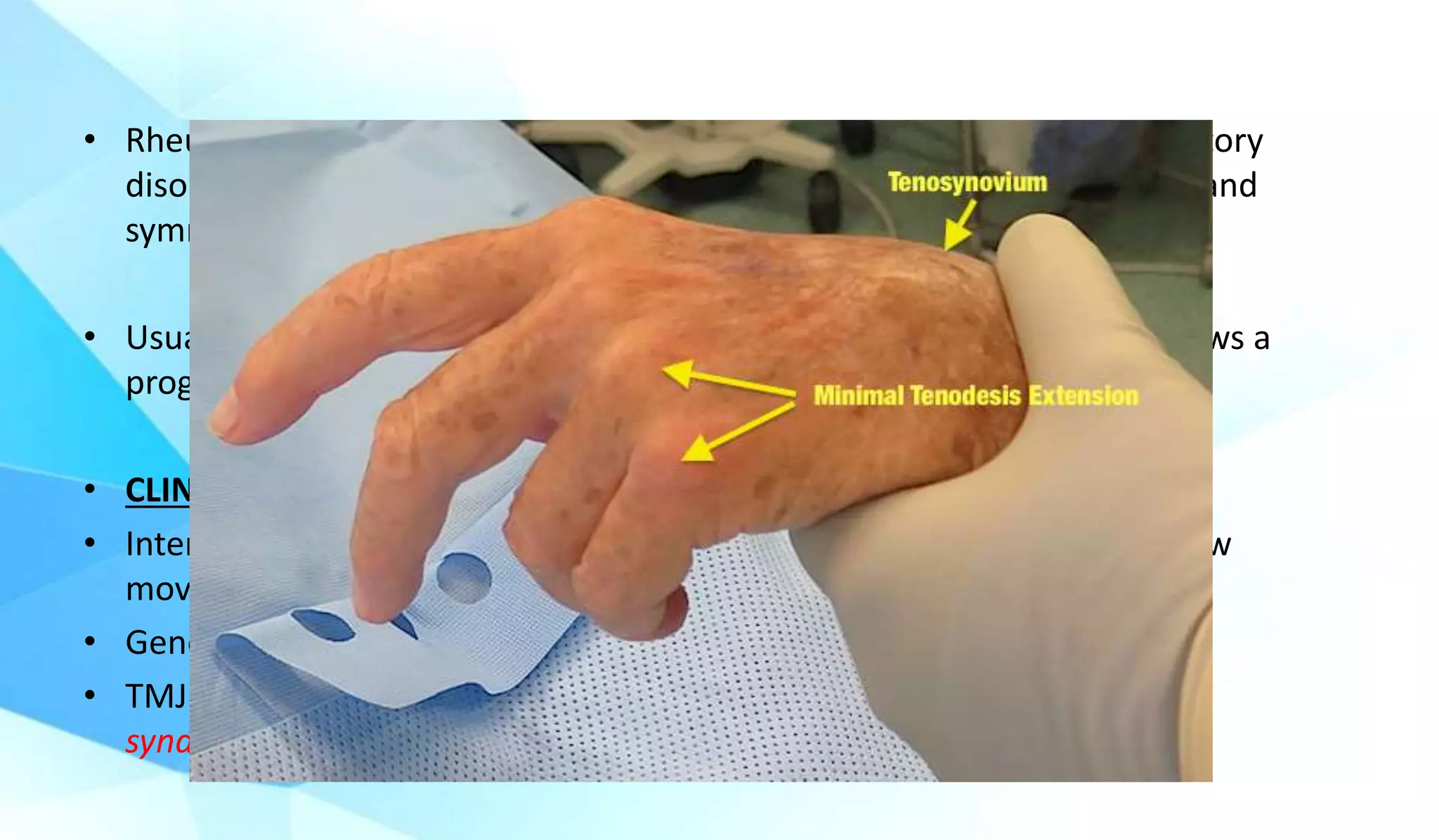 Degenerative joint disorders of temporomandibular joint | PPTX
