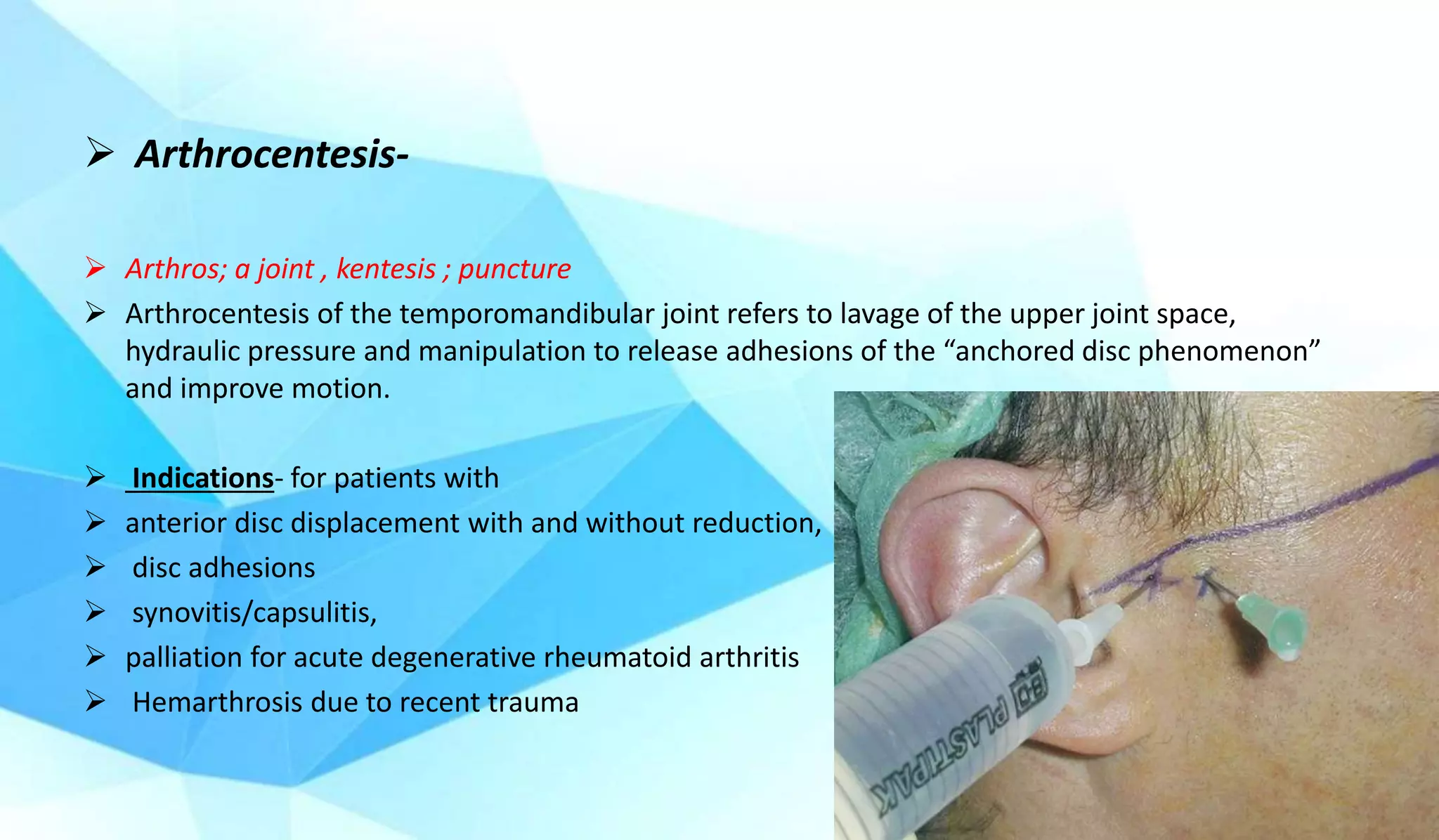 Degenerative joint disorders of temporomandibular joint | PPTX