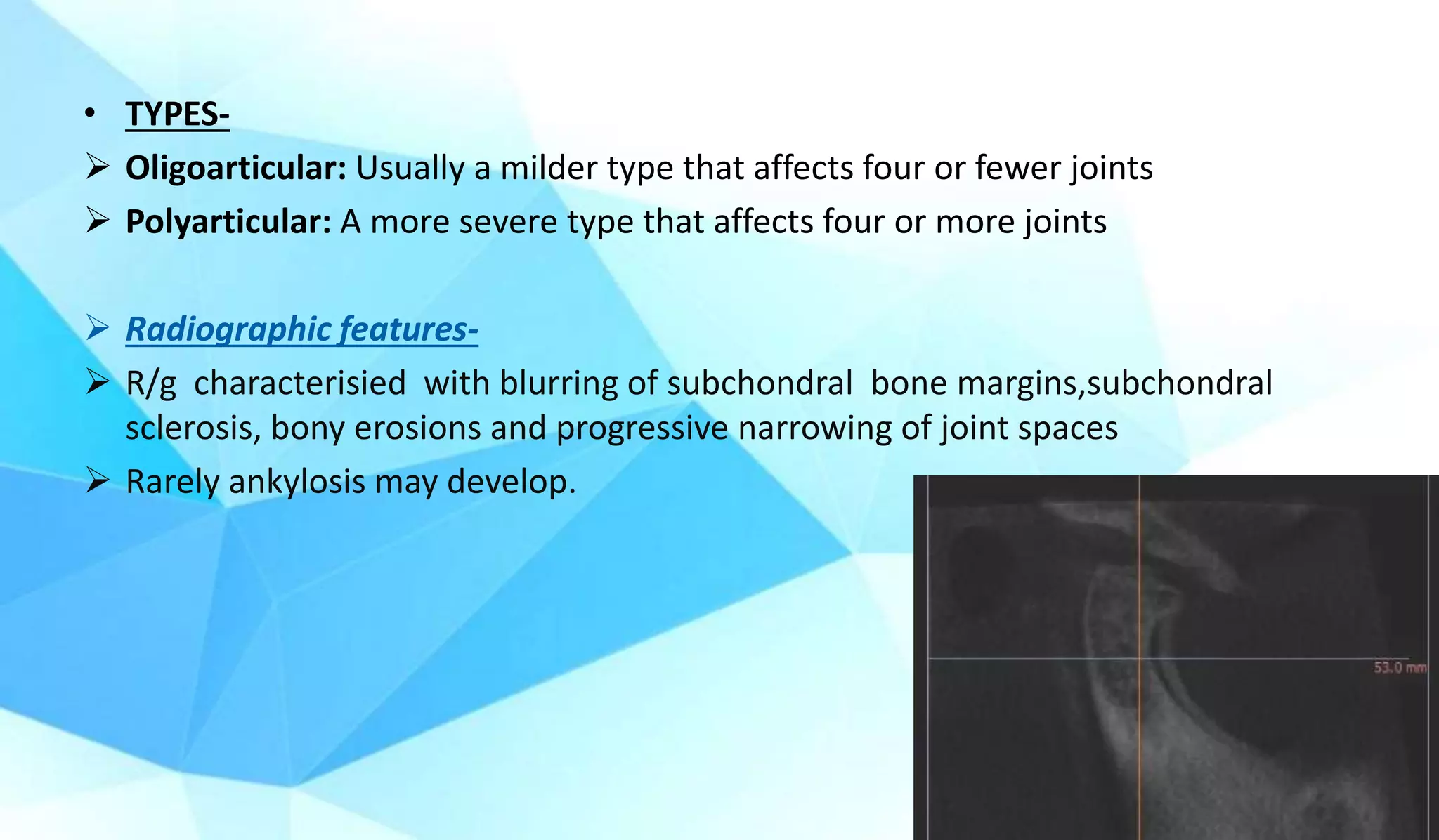 Degenerative joint disorders of temporomandibular joint | PPTX