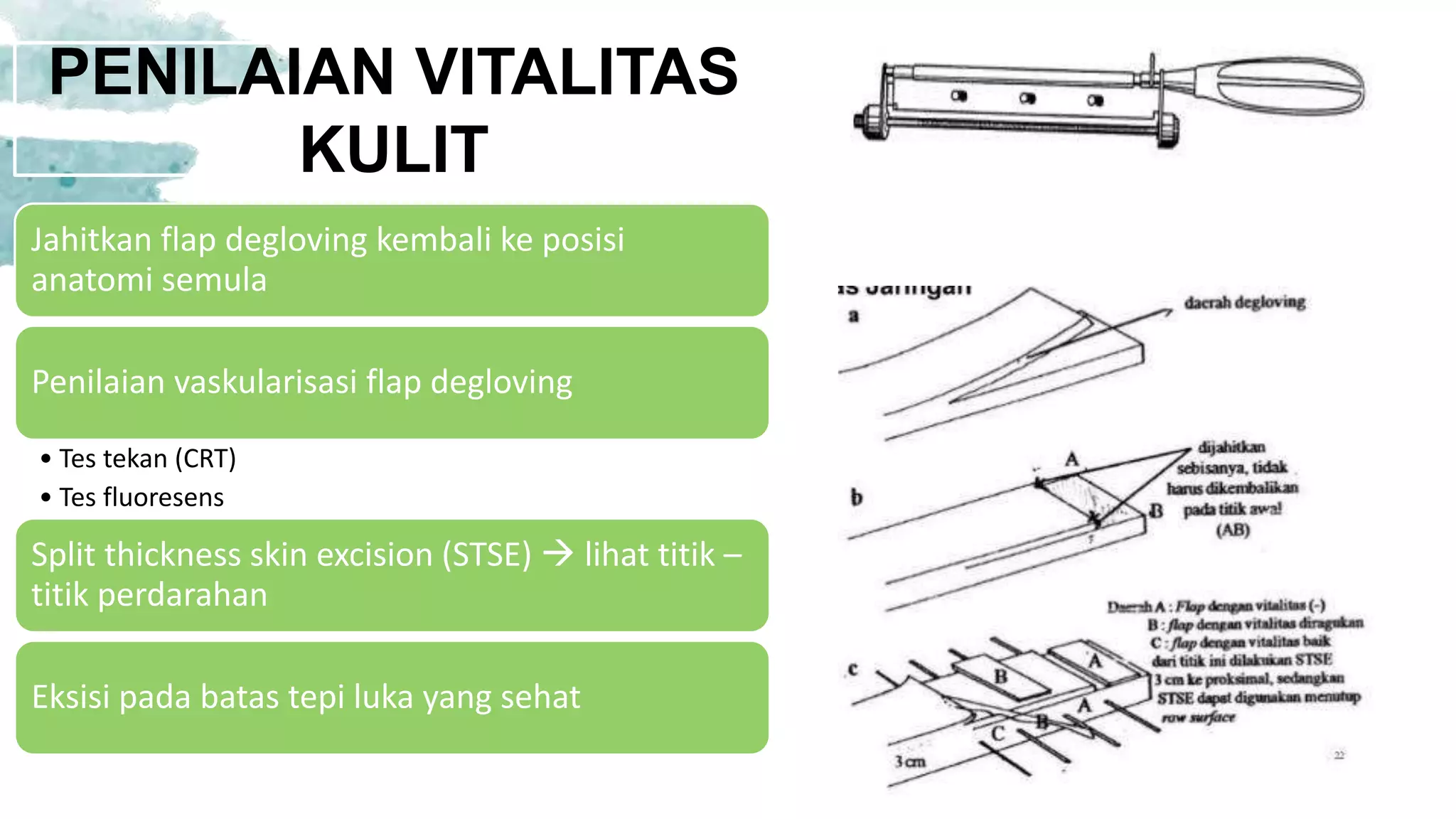 degloving injury - Andi.pptx