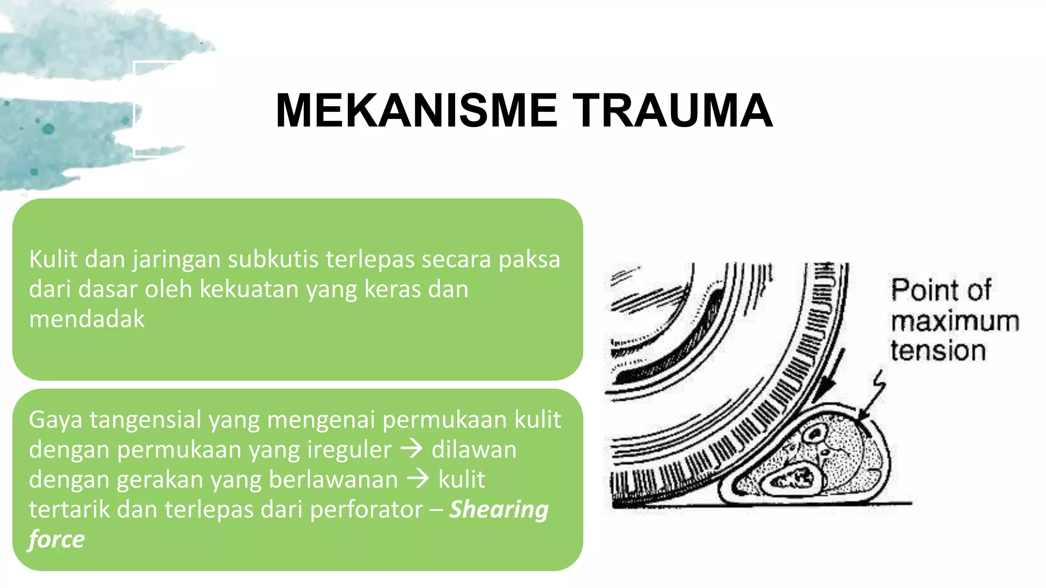degloving injury - Andi.pptx