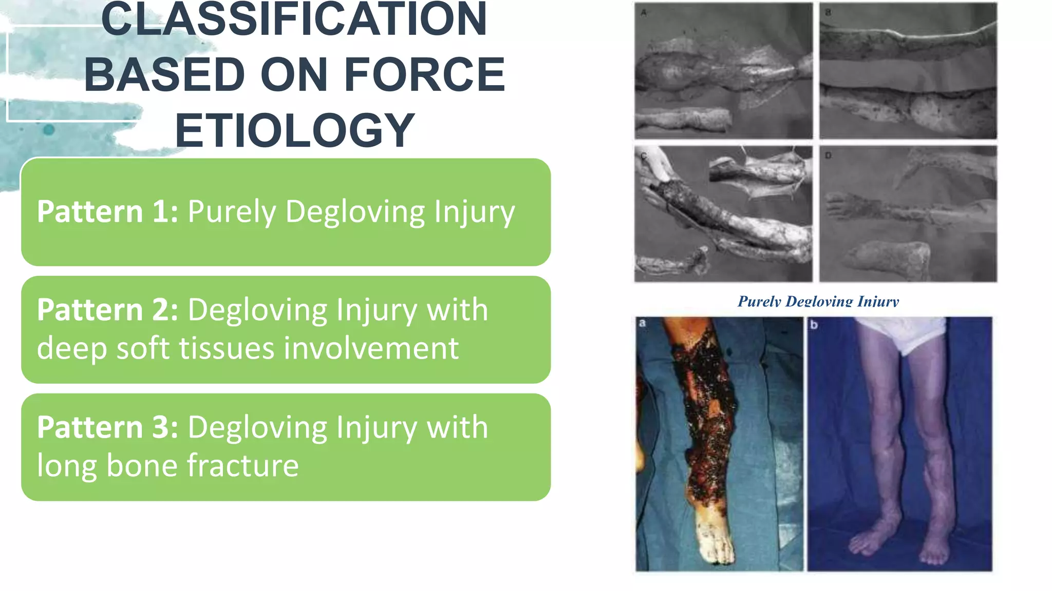 degloving injury - Andi.pptx