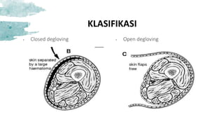 degloving injury - Andi.pptx