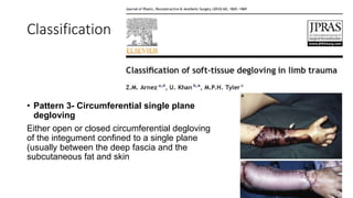 Degloving wound.pptx