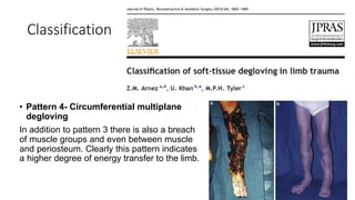 Degloving wound.pptx