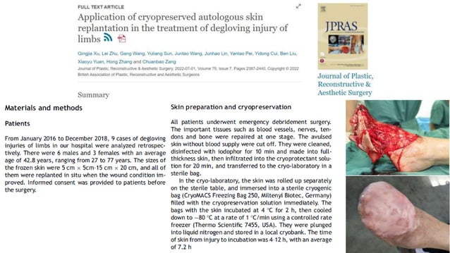 Degloving wound.pptx