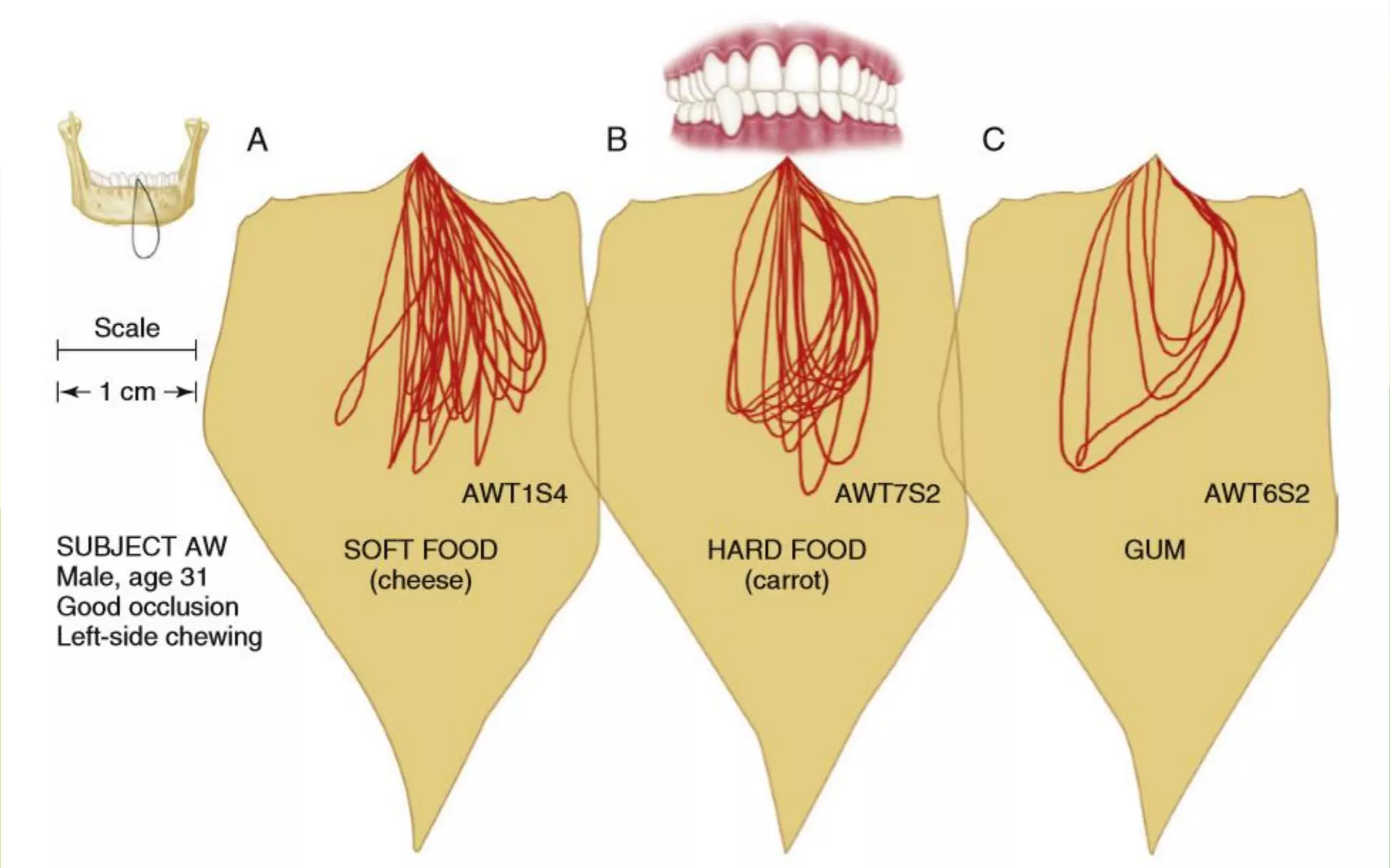 Deglutition and Chewing cycle _Dr. Pratistha | PDF | Dental Health ...