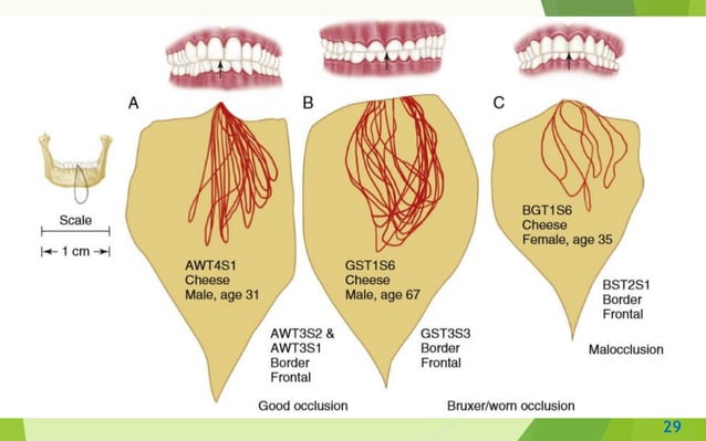 Deglutition and Chewing cycle _Dr. Pratistha | PDF | Dental Health ...