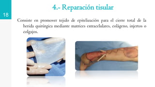 DEHISCENCIA QUIRURGICA ppt enfermería quirúrgica. Universidad del istmo ...