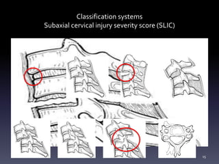 Subaxial Cervical Spine Injuries | PPTX