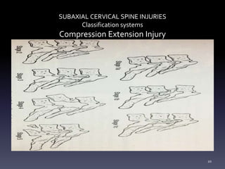 Subaxial Cervical Spine Injuries | PPTX