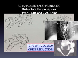 Subaxial Cervical Spine Injuries | PPTX