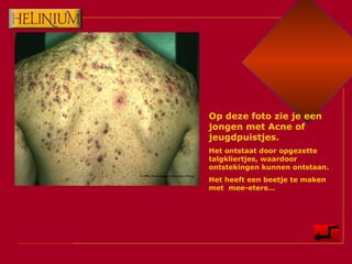 De Huid Zelfstudie | PPS