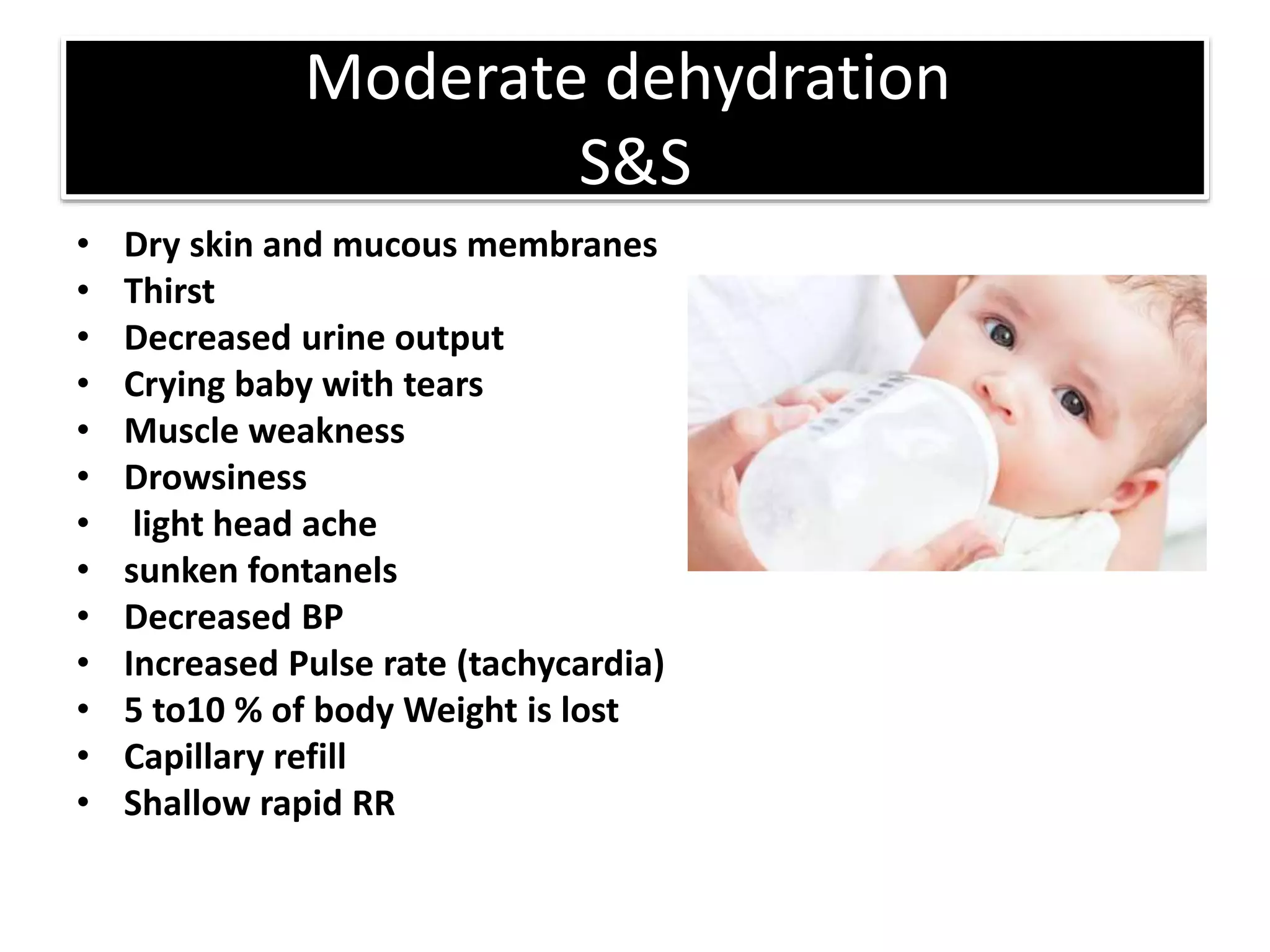 Dehydrated child (TUCOM) | PPTX