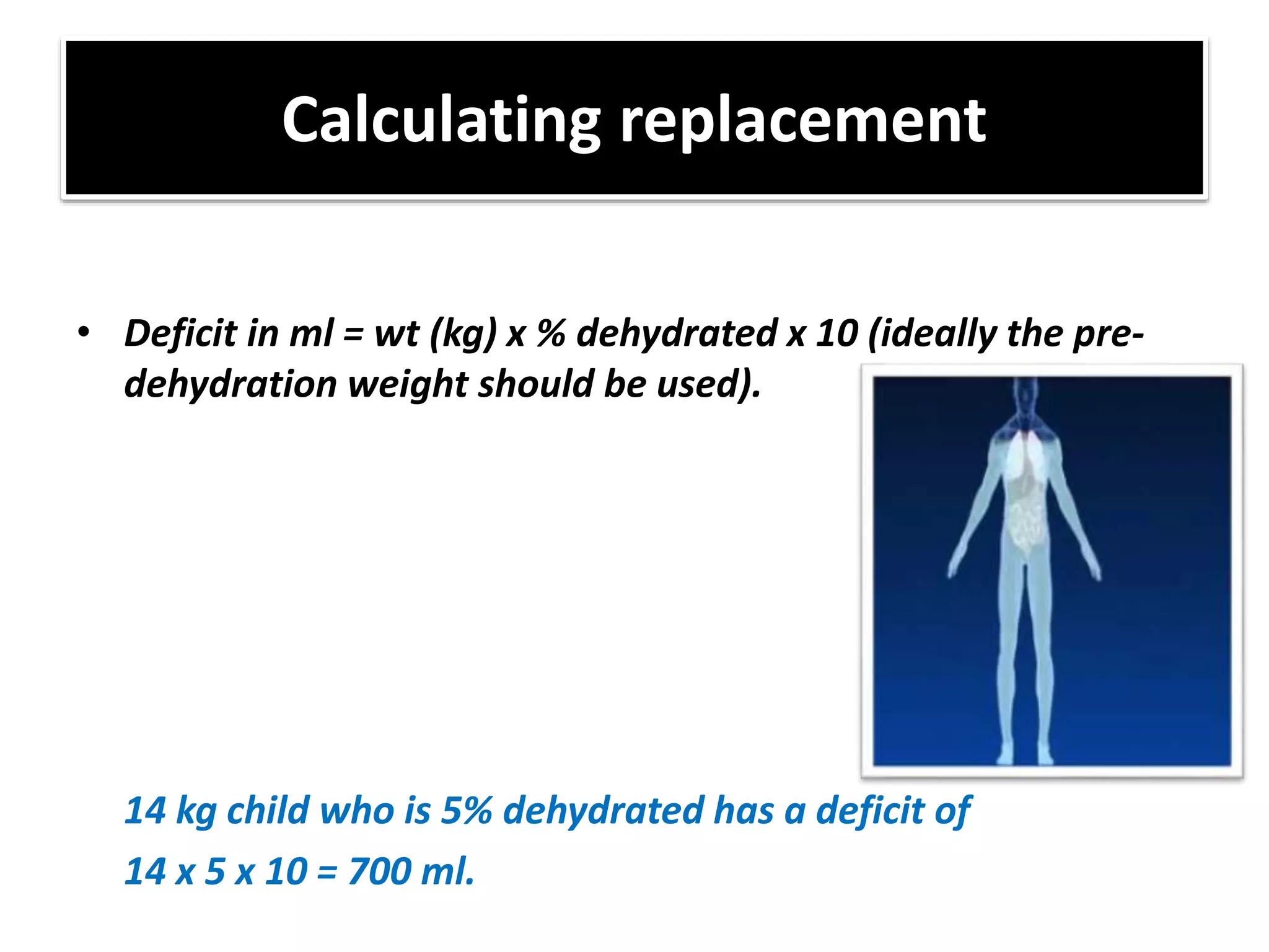 Dehydrated child (TUCOM) | PPTX