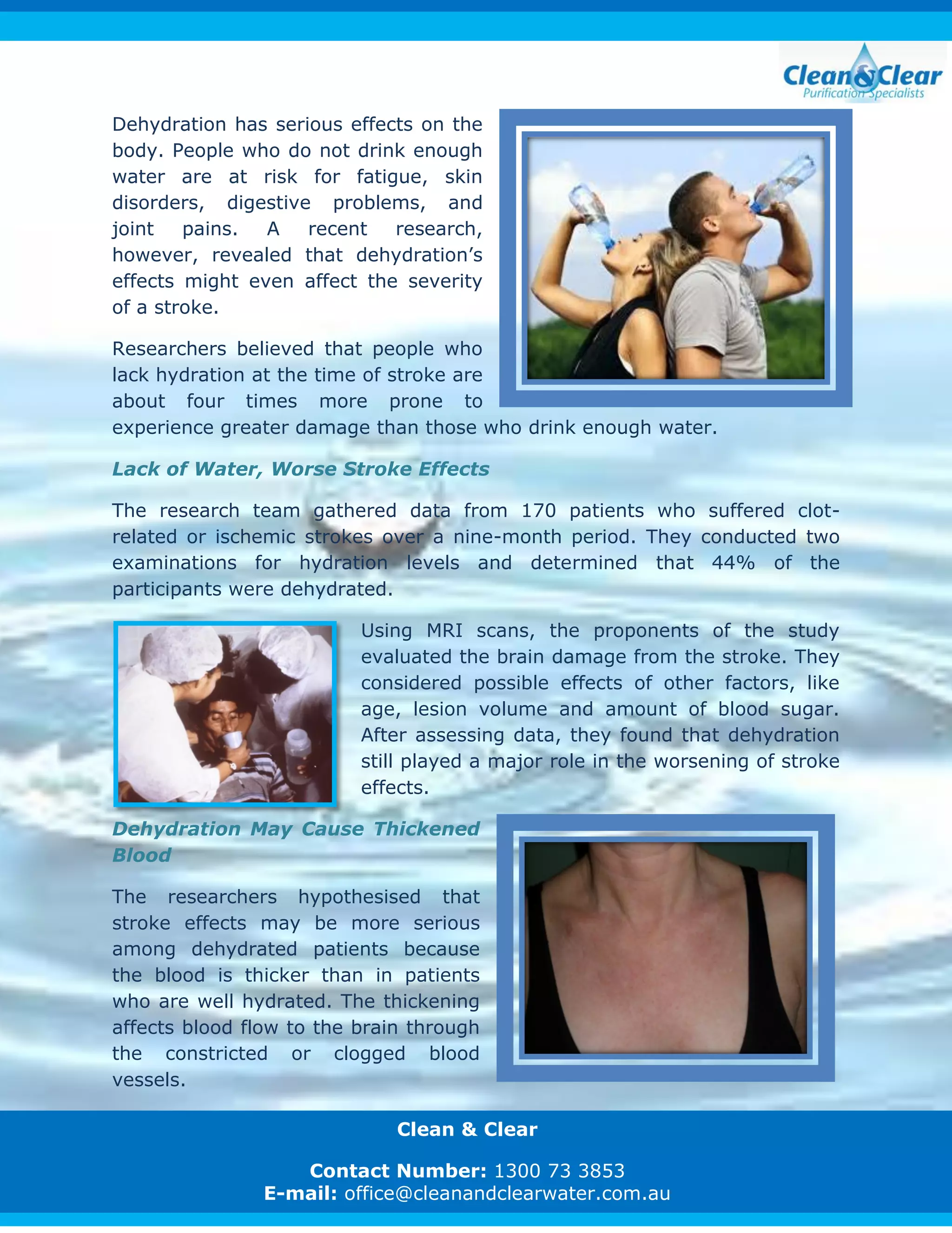Dehydration: A Risk Factor for Serious Stroke Effects | PDF