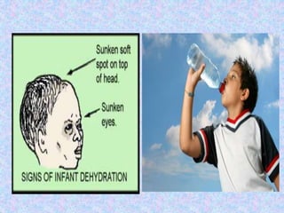 Dehydration In children | PPT