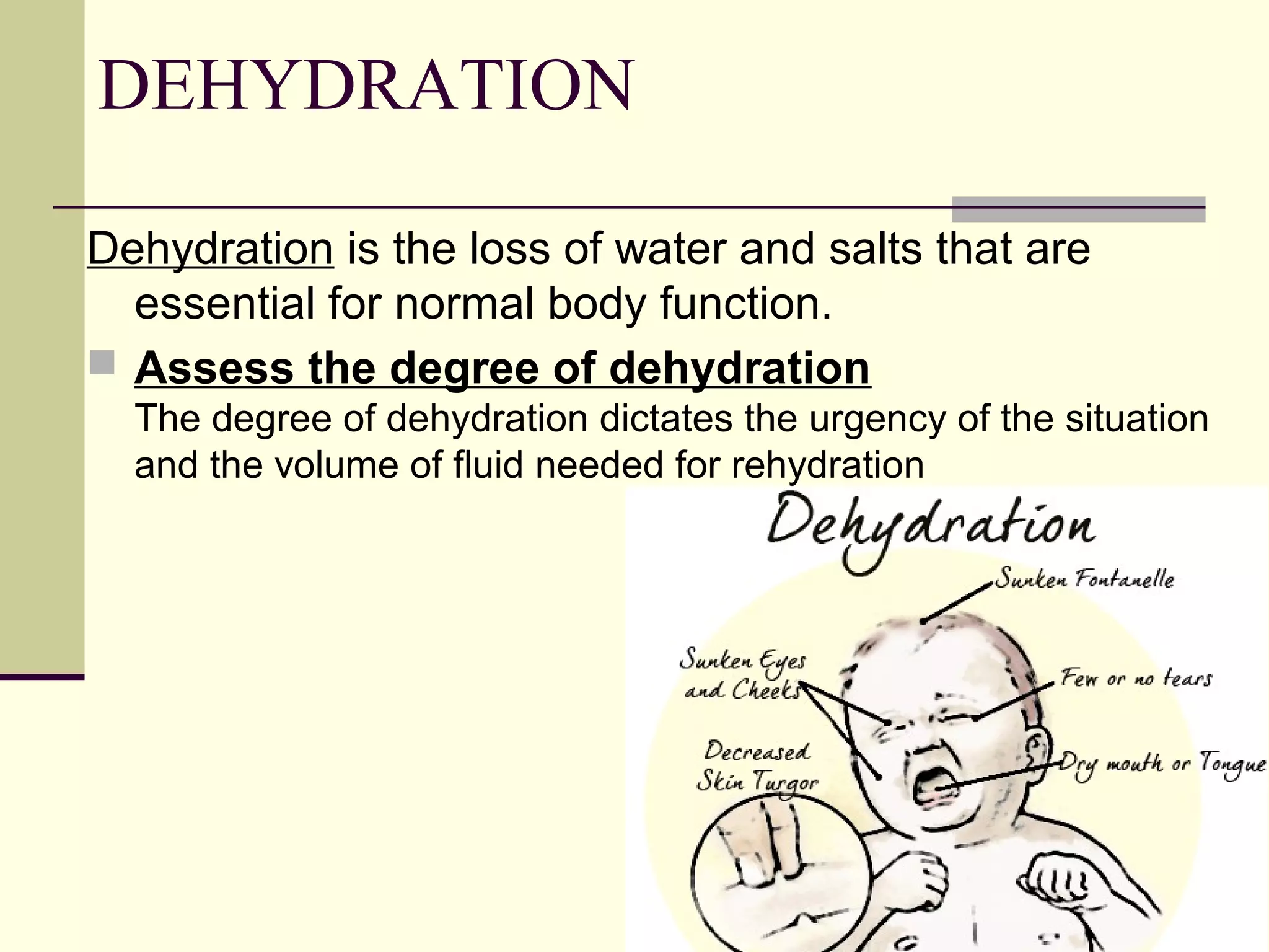 Dehydration imnci | PPT
