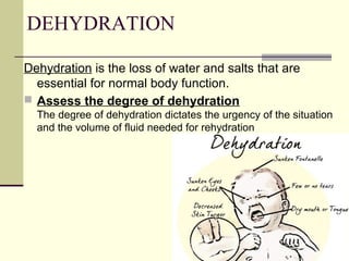 Dehydration imnci | PPT