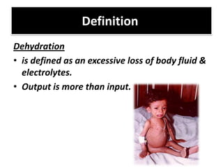 Dehydration in children | PPTX