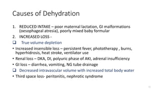 DEHYDRATION PEDIATRICS PRESENTATION (1).pptx