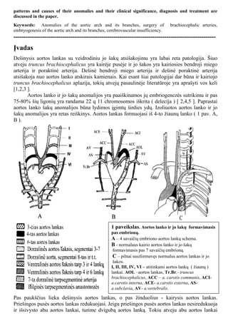 Dešinysis aortos lankas su veidrodiniu brachiocefalinių arterijų atsišakojimu, kairiojo truncus ...