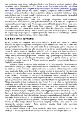 Dešinysis aortos lankas su veidrodiniu brachiocefalinių arterijų atsišakojimu, kairiojo truncus ...