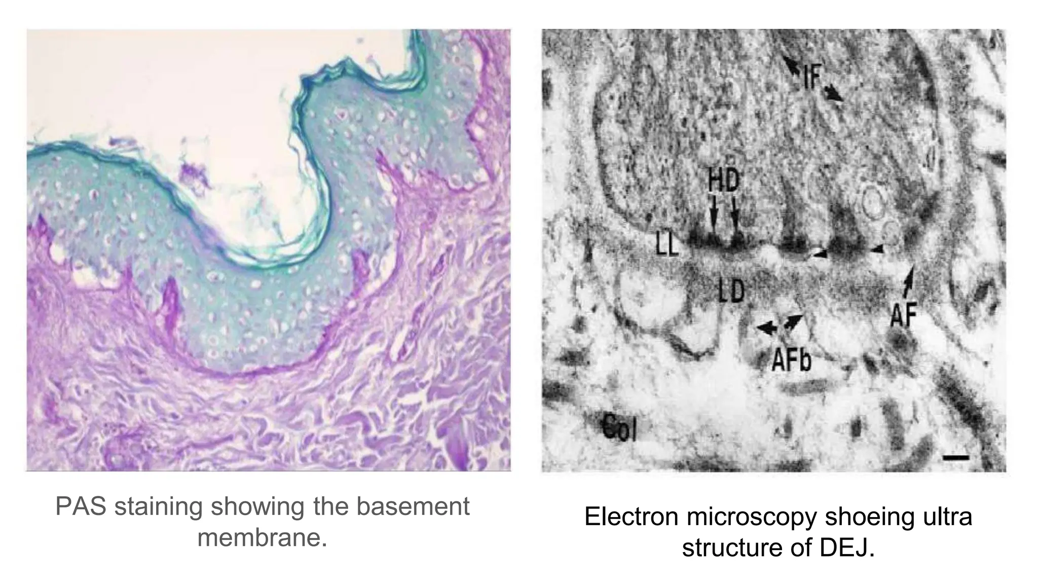 DEJ and Applied aspects.pptx