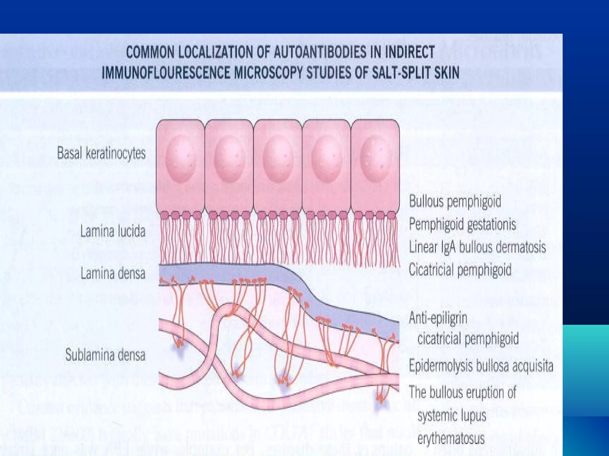 Dermo epidermal junction | PPT
