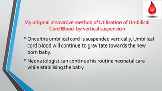 Umbilical cord blood utilization by vertical suspension alternative to ...
