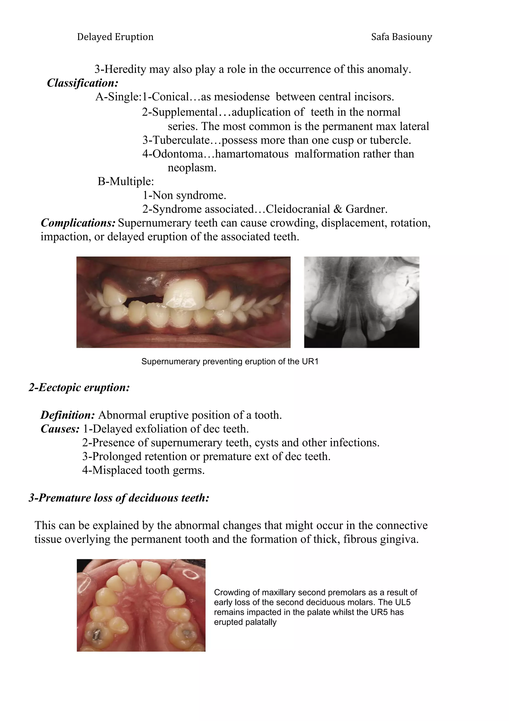 delayed eruption in dentistry.pdf