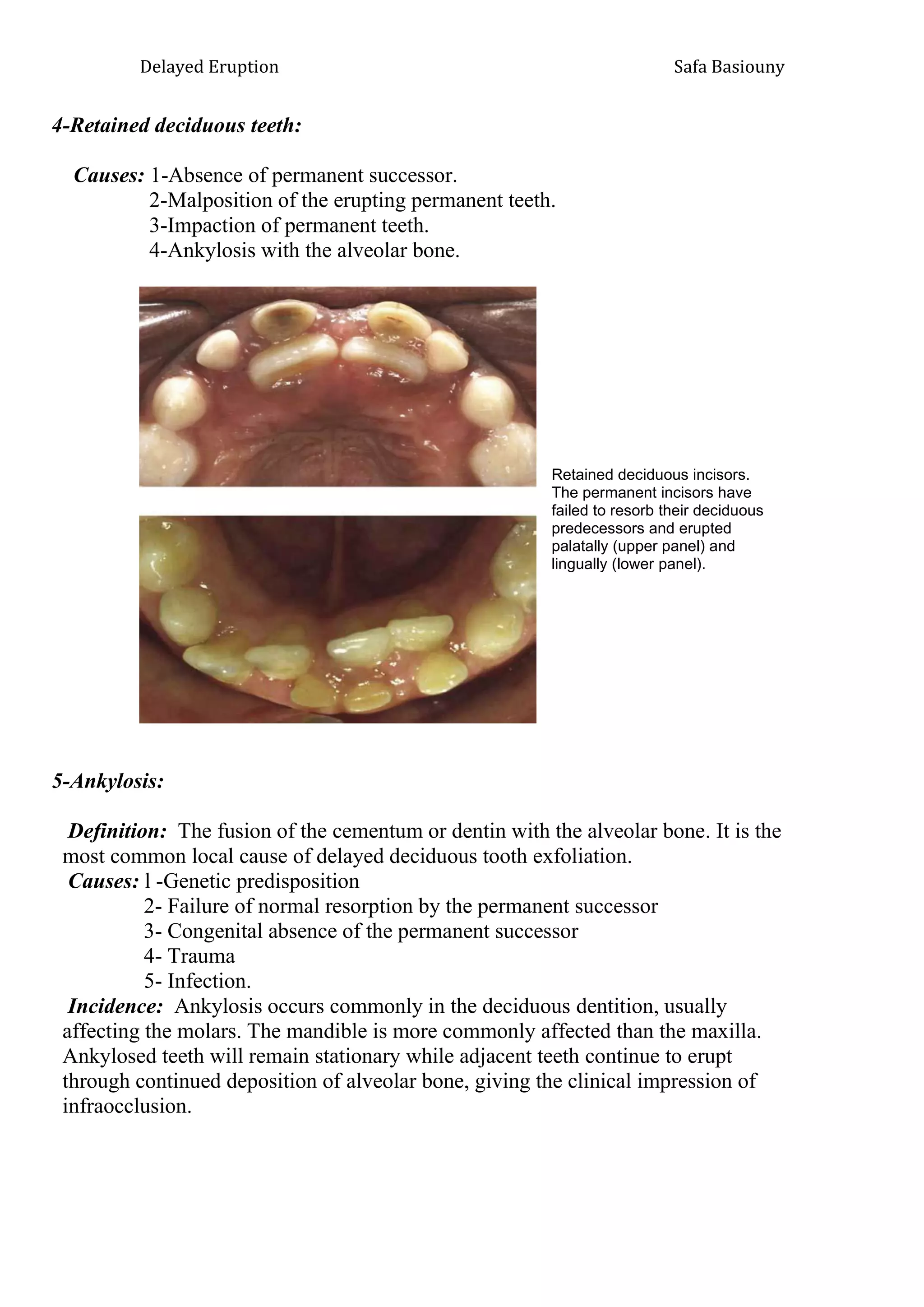delayed eruption in dentistry.pdf