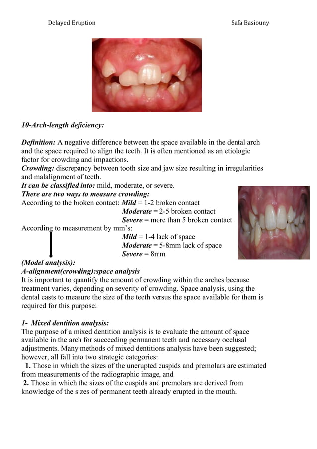 delayed eruption in dentistry.pdf