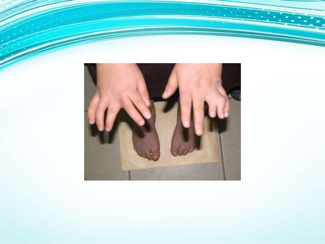 Disorders Of Puberty Dr Trynaadh
